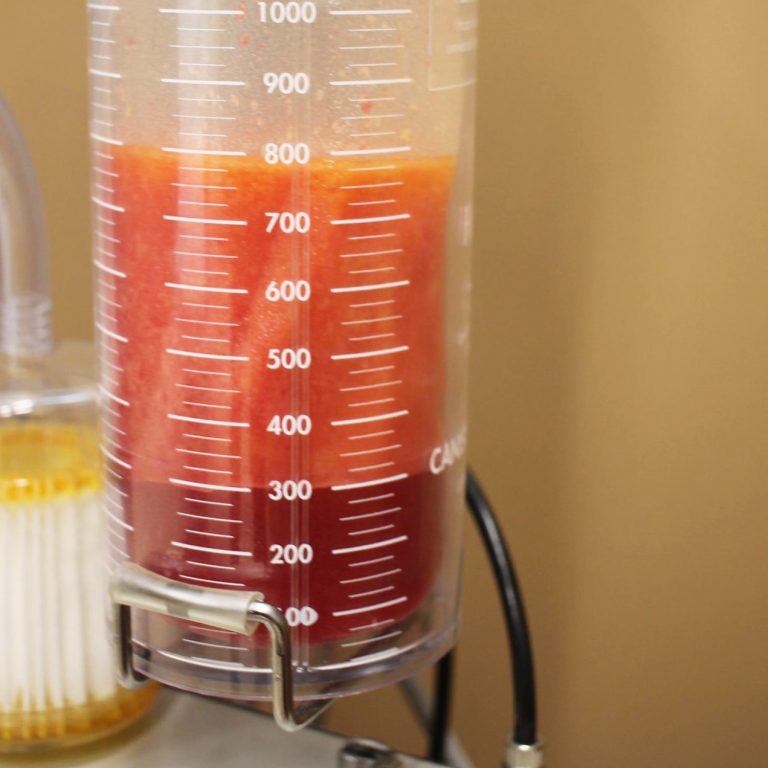 Natural breast augmentation with fat transfer in Wisconsin